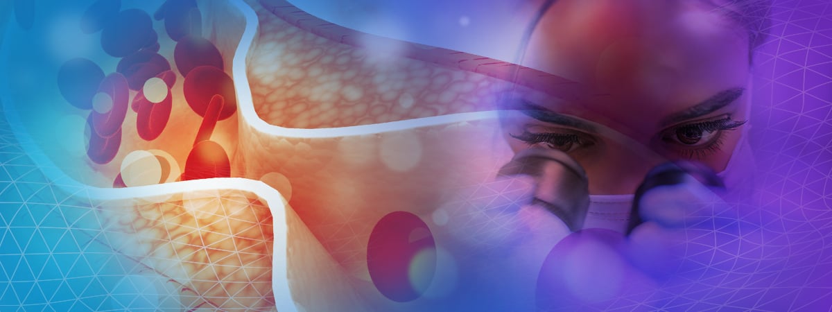 Arthrosis Classification - Bio Lexicon
